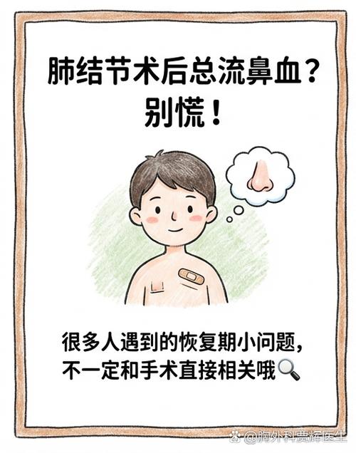 肺结节会流鼻血吗图标