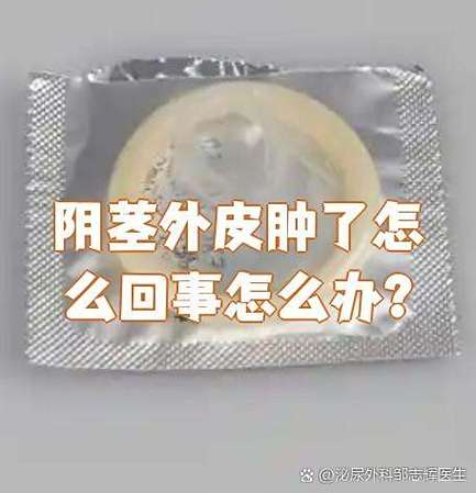 生殖外皮肿大是什么原因截图