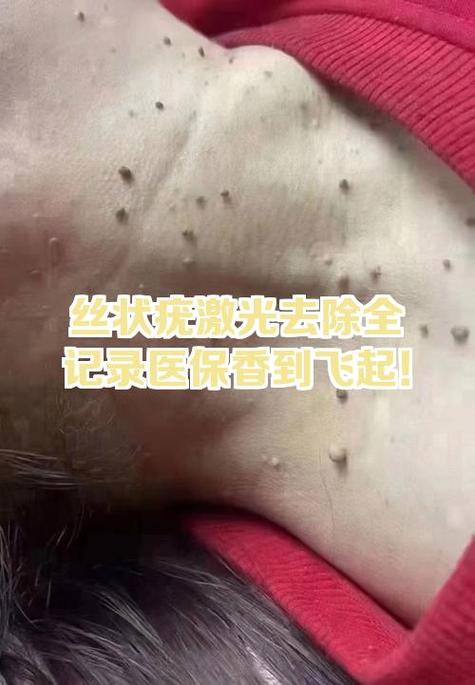 皮肤科做激光可以用医保吗截图