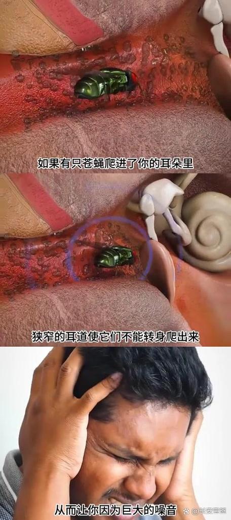 耳朵进蚊子怎么办截图