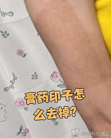 怎样去掉膏药留在身上的印截图