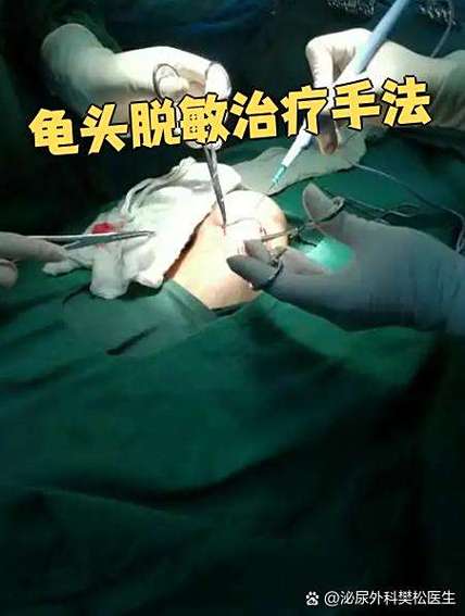 龟脱敏针一旦用了就不能停吗图标