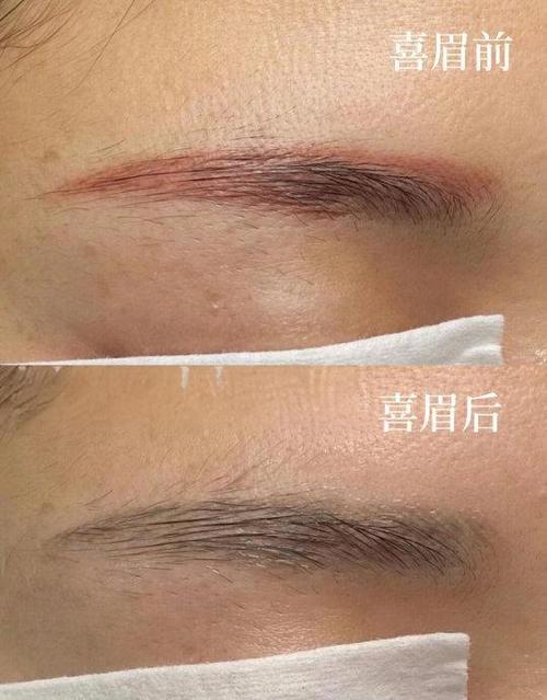 纹眉后变蓝色好还是红色好图标