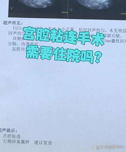 宫腔粘连手术要住院吗图标
