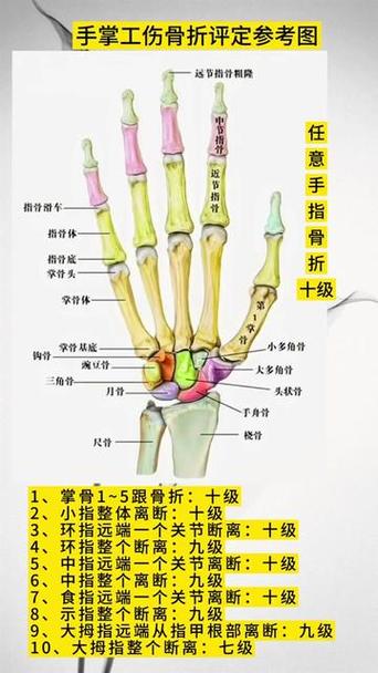 掌骨骨折算几级伤残图标