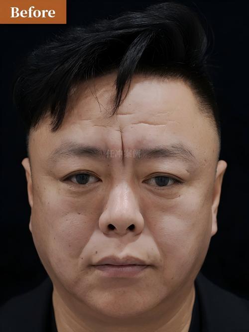 脸颊上有两道横纹代表什么截图