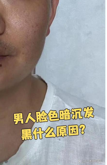 脸色发暗是什么原因图标