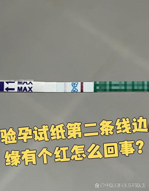 液晶显示器边缘泛红图标