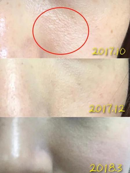 胶粘在皮肤上怎么去除图标