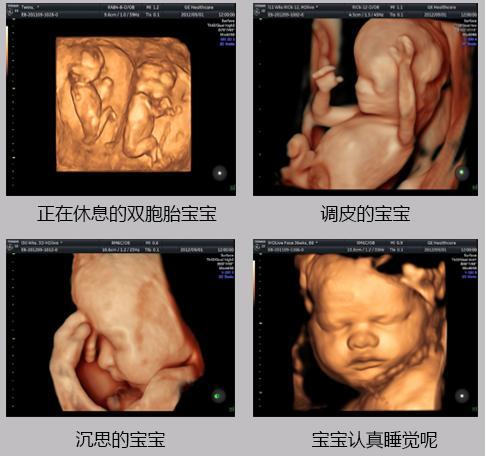 四维和三维哪个好