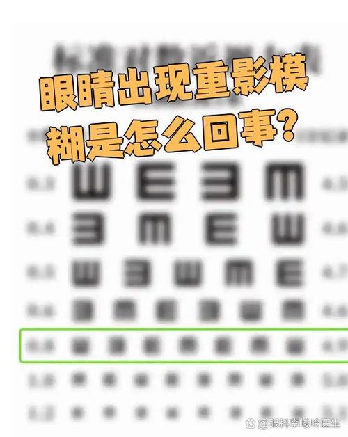 眼睛出现重影图标