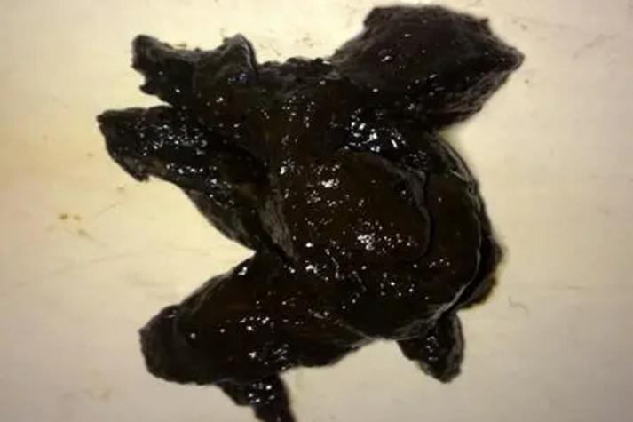 流鼻血拉黑色大便图标