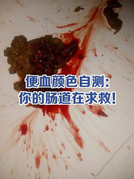 火酒杀扣多少滴血截图