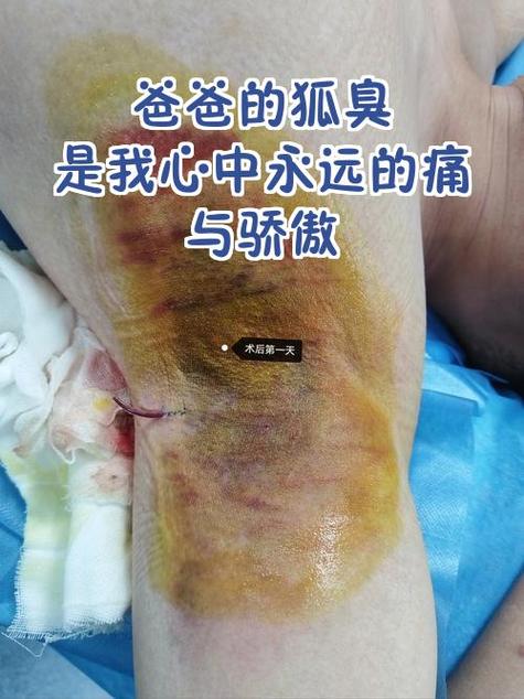 有狐臭可以当警察吗图标