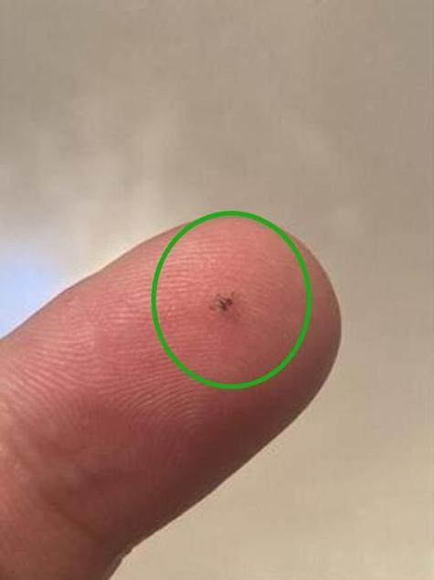 阴虱扔在房间地上还能活吗