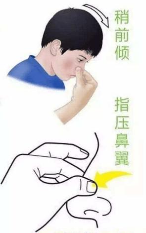 流鼻血应该做什么图标