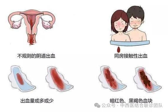 女人闭经前的5大症状图标