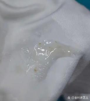 咳嗽出一坨一坨的灰色痰图标