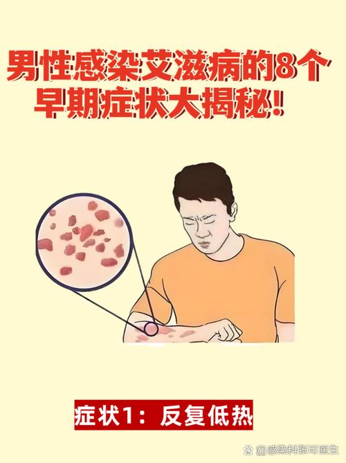 艾滋病早期症状