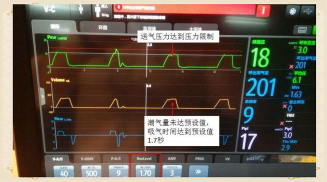 飞利浦呼吸机的报警提示图标