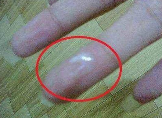 同房出现白色浆糊分泌物正常吗图标