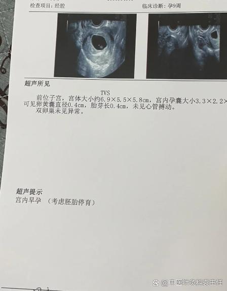 怀孕六周只见暗区图标