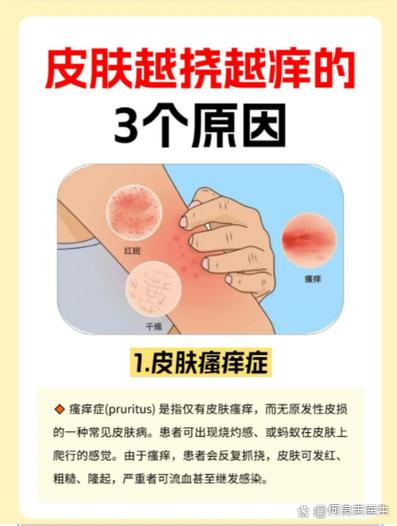 皮肤瘙痒的病因图标
