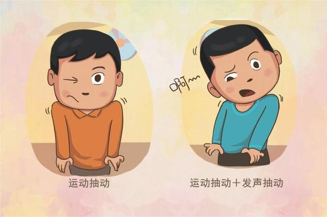 不自主运动的临床症状