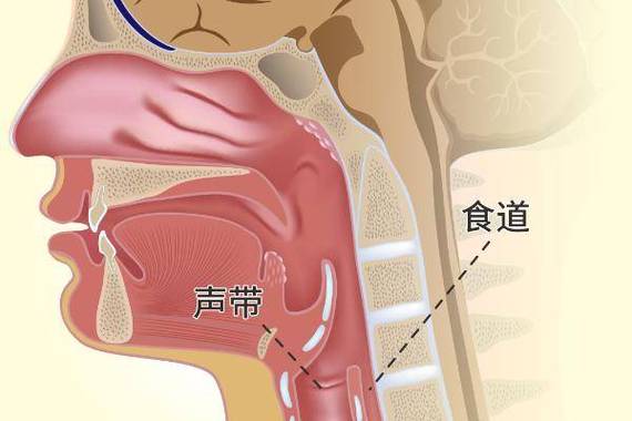 声带小结是什么原因引起的?图标