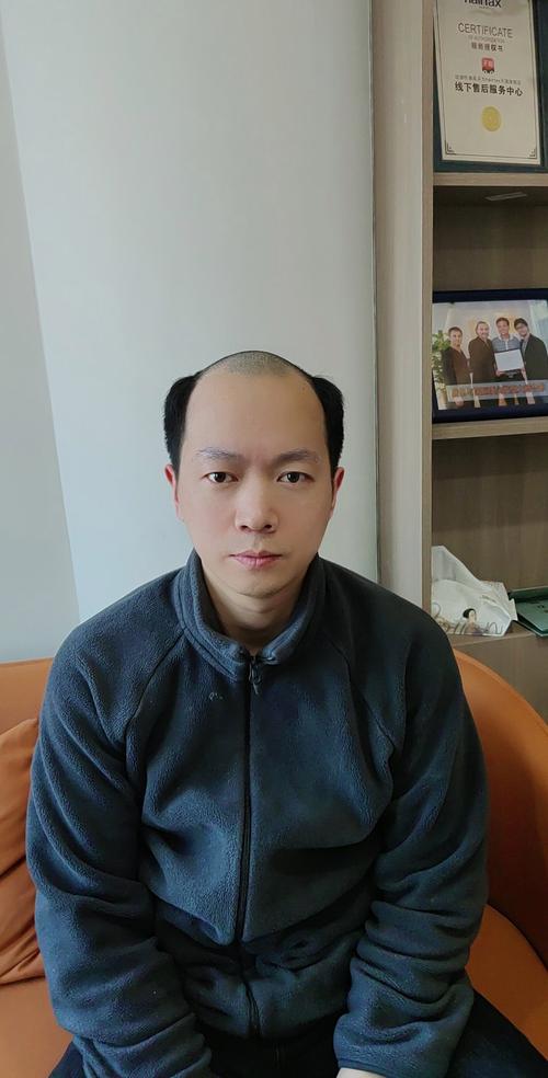 男人尖头顶的民间说法图标