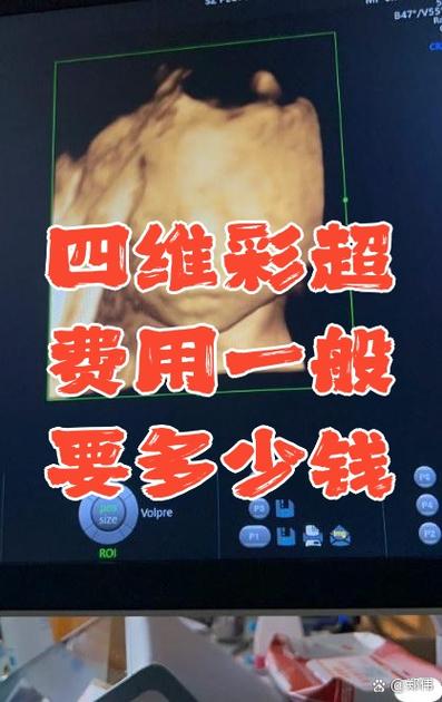 检查四维要多少钱图标