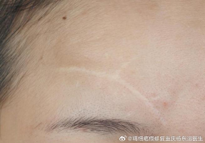 手机屏幕进水有白线条图标