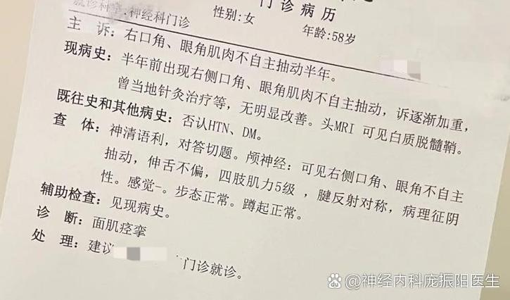 眼睛肌肉抽搐怎么回事图标