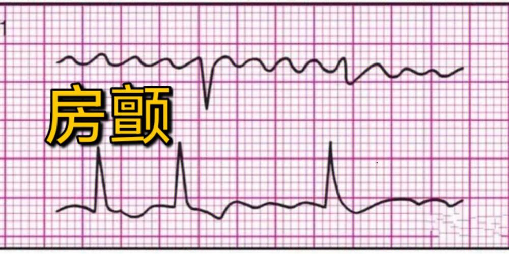 房颤手术10万报销多少截图