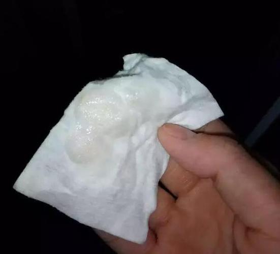 白色分泌物有点黄黄的