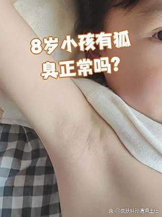 13岁女孩有狐臭怎么办截图