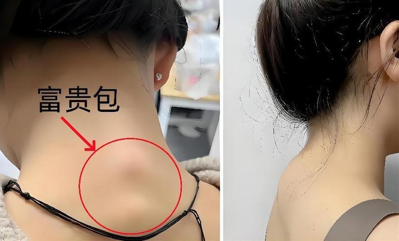 怎么判断自己有没有富贵包图标