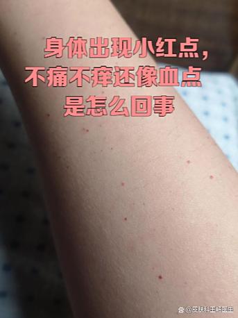 皮肤长红点图标
