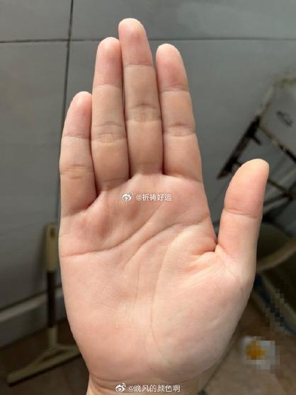 手机调高照片清晰度图标