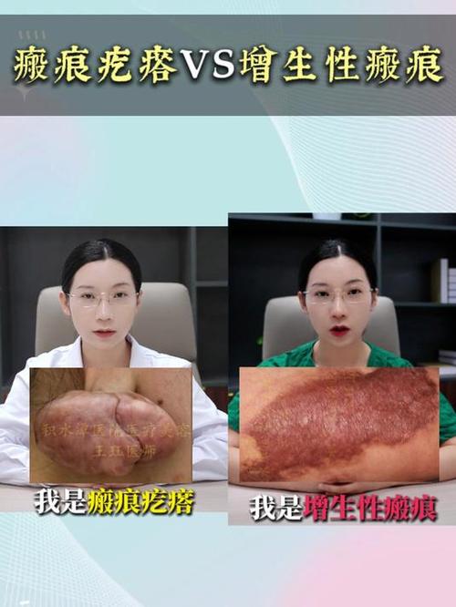 瘢痕和疤痕的区别截图