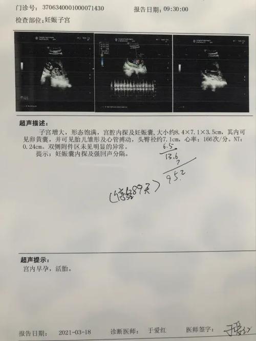 做nt要提前去医院预约吗图标