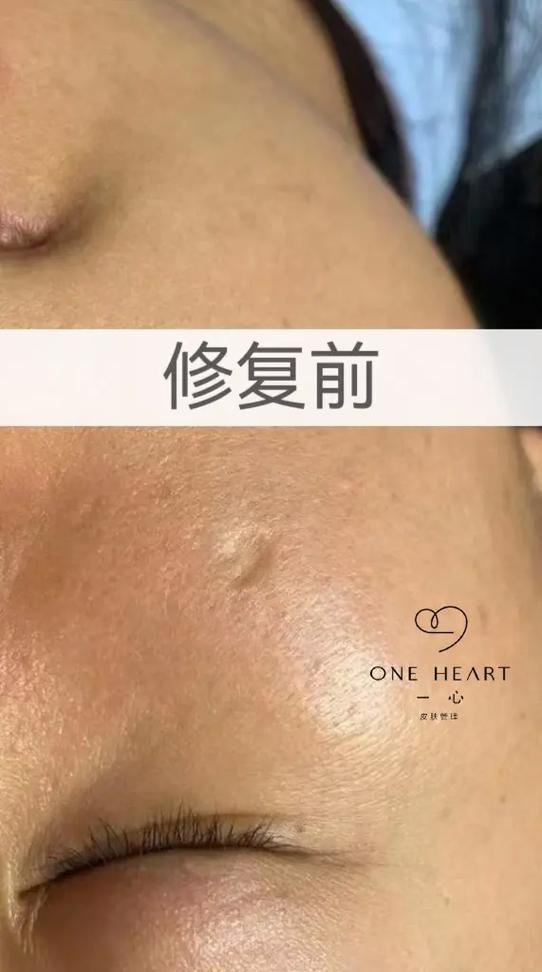360电话手表进水黑屏了看不见了图标