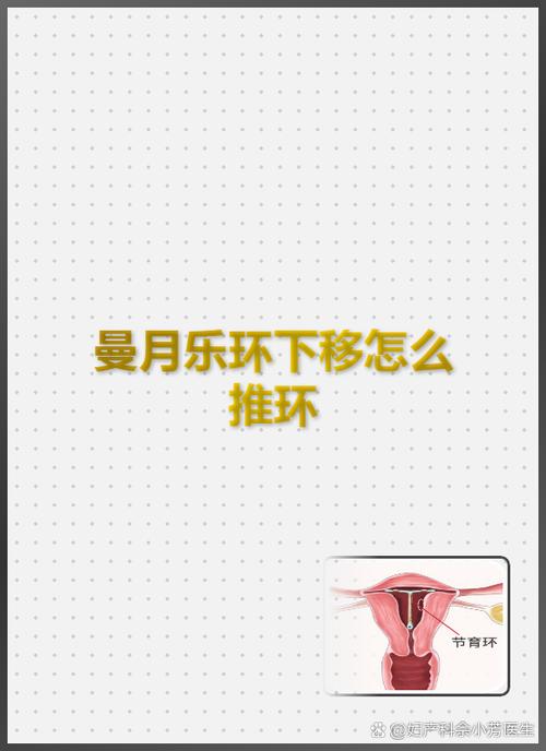 上曼月乐环10大忌图标