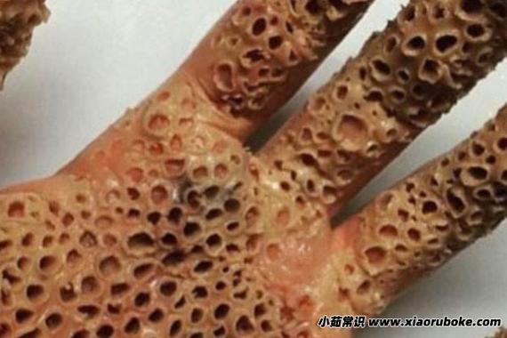 网上说芝麻人什么意思截图