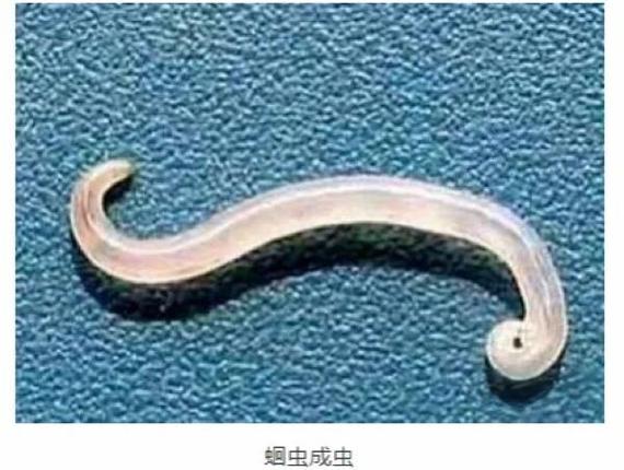 怎么检查人感染了宠物寄生虫图标