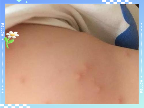 睡很久没睡的床身上长包图标