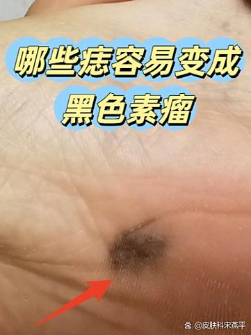 扫一扫识别痣图标