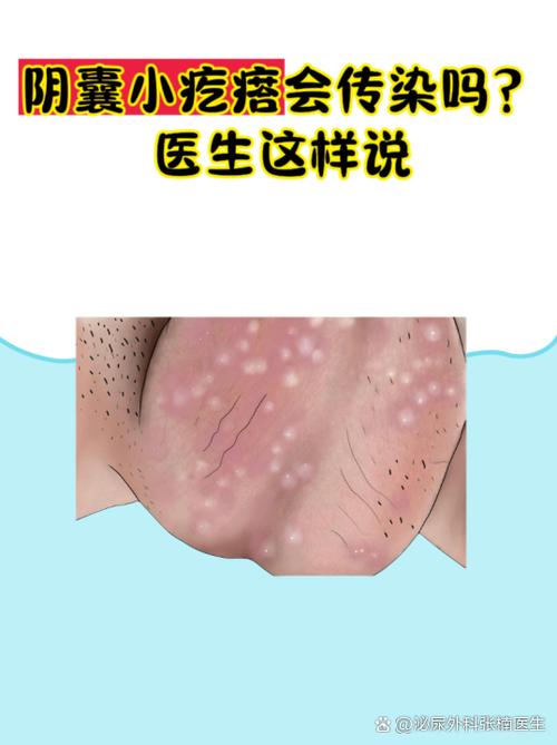 孩子起了一身小红疙瘩图标