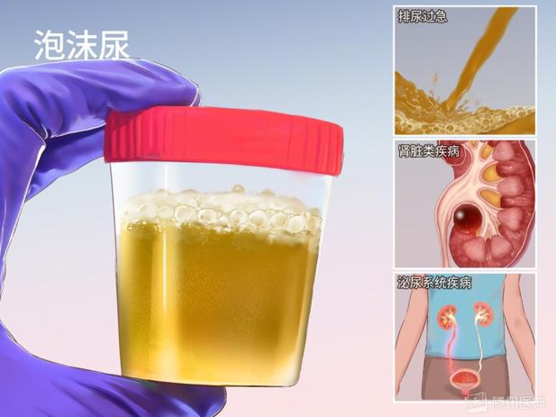 小伙长期乱吃药致终身透析图标