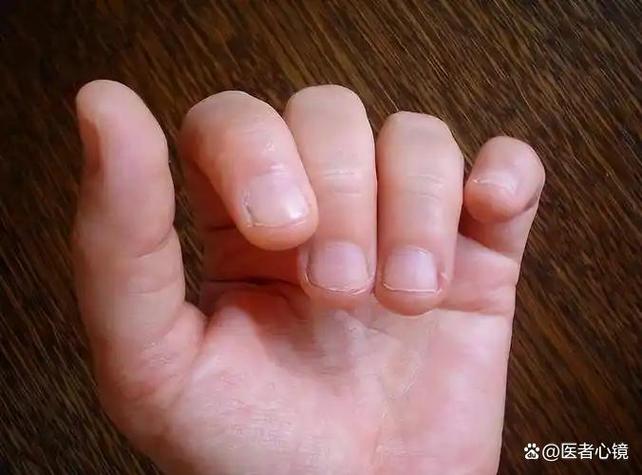 手指头圆好还是尖好图标